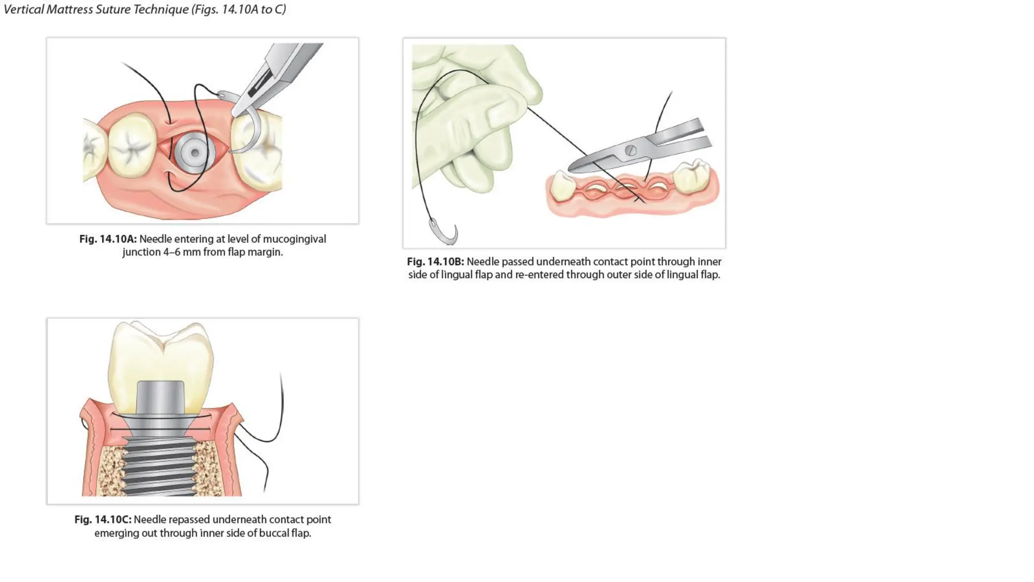Suture techniques.pdf