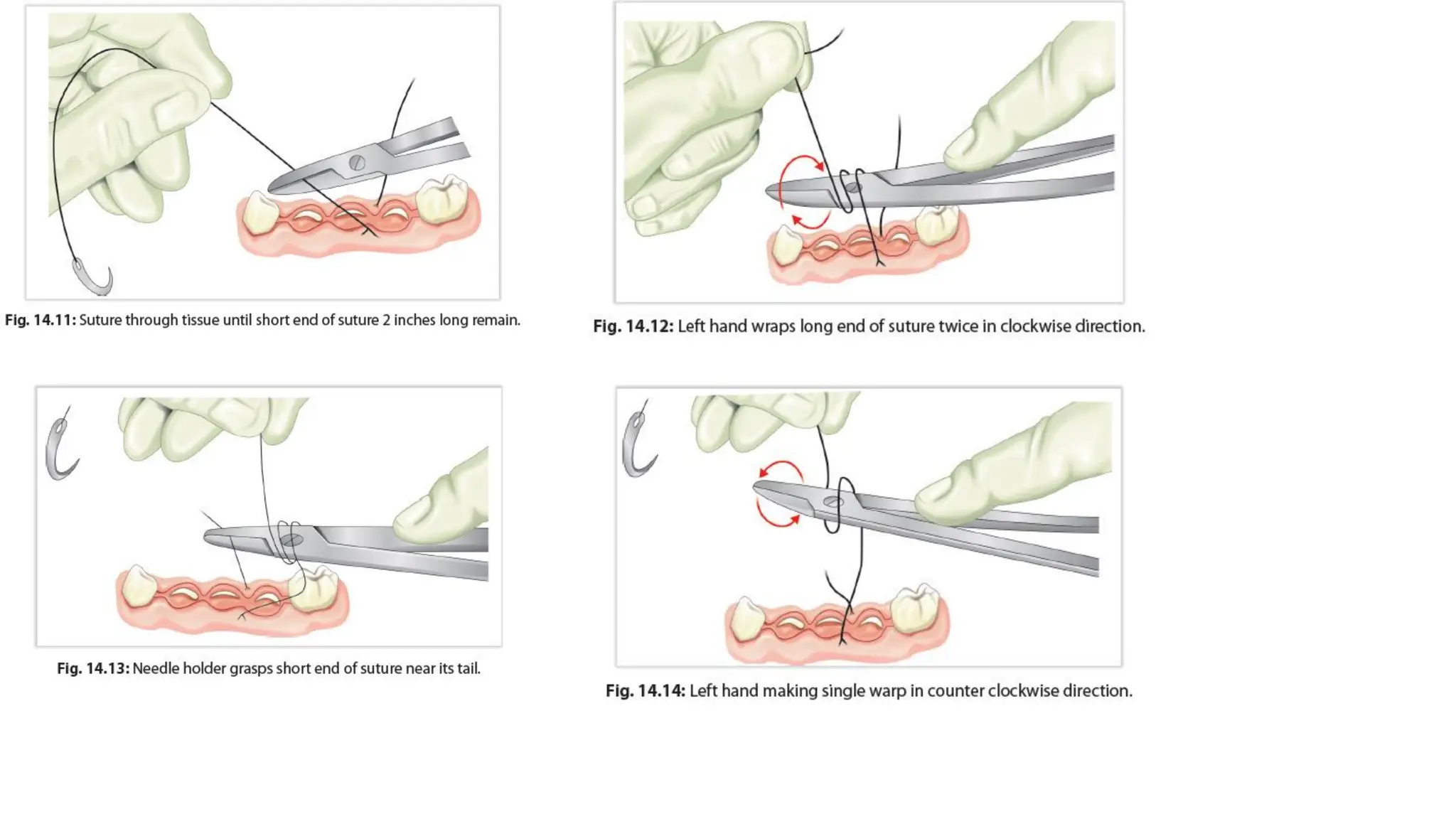 Suture techniques.pdf