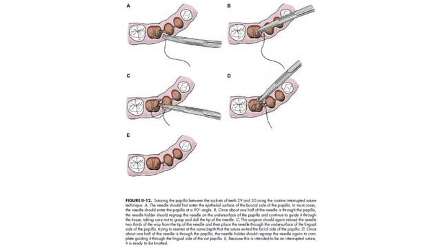 Suture techniques.pdf