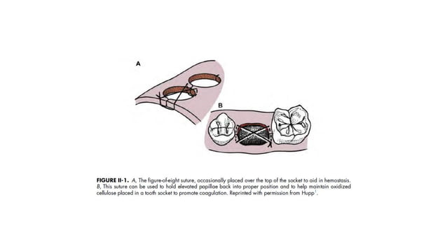 Suture techniques.pdf