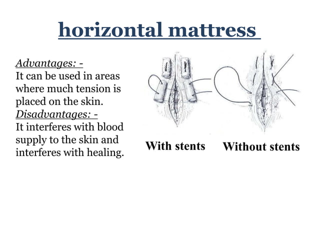 Suture training course | PPTX