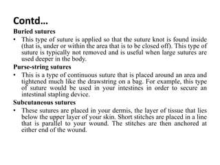 Suturing | PPTX