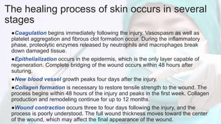 The basics of Suturing | PPTX