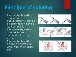Medical surgical and pathophysiology and wound suturing | PPTX