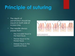 Medical surgical and pathophysiology and wound suturing | PPTX