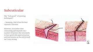 JUMC SSIG Suturing 101 | PPTX