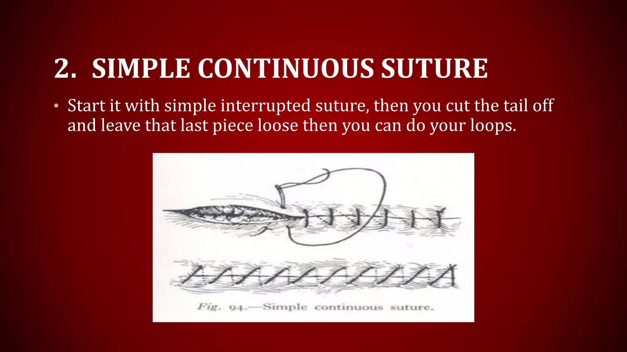 Suturing and its technique | PPTX