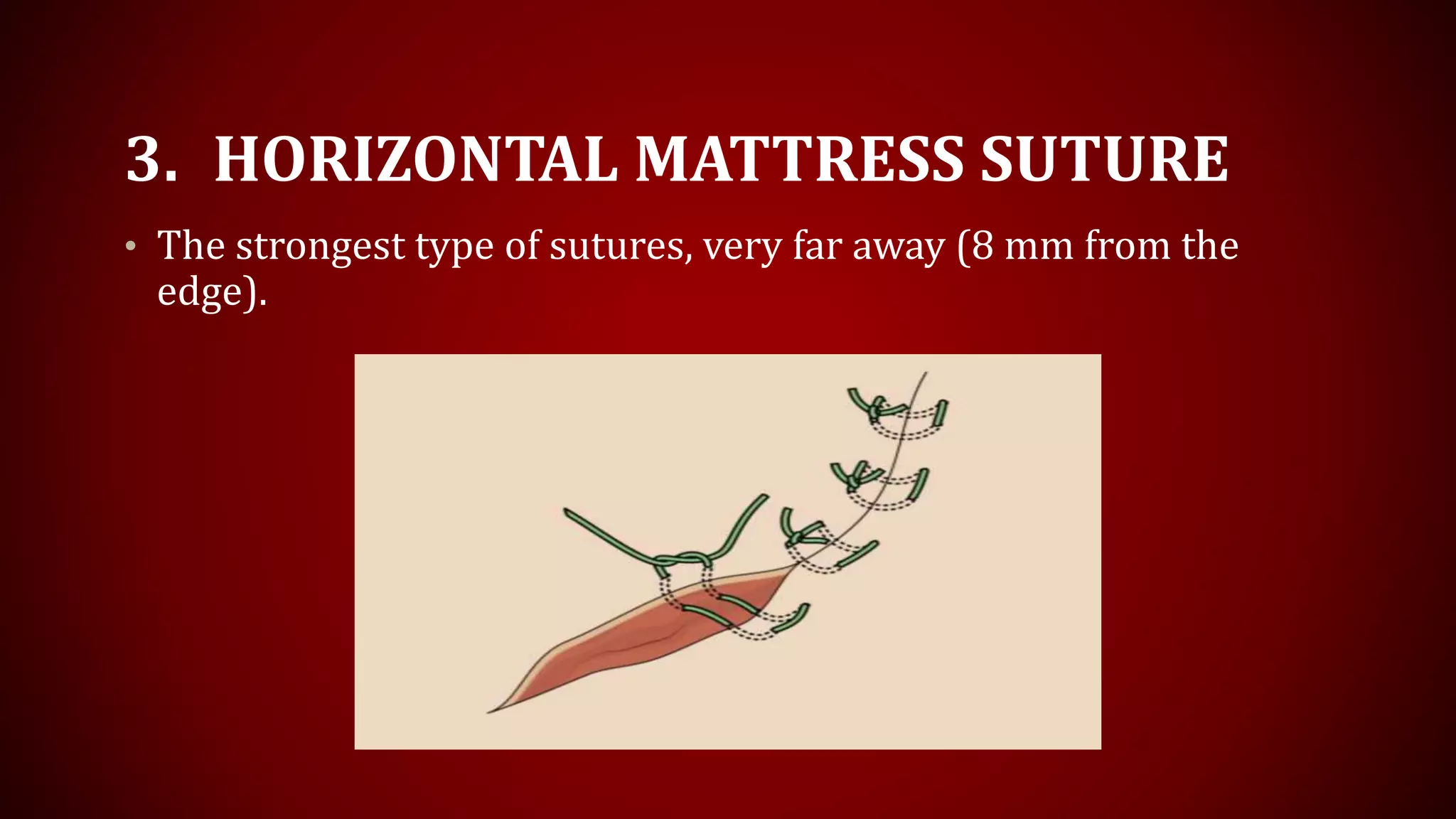 Suturing and its technique | PPTX