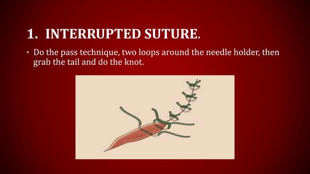 Suturing and its technique | PPTX | First Aid | Injuries