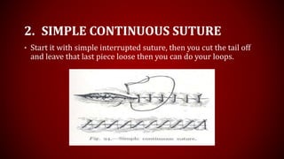 Suturing and its technique | PPTX