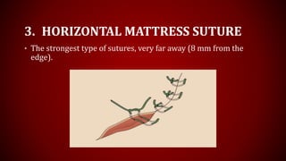 Suturing and its technique | PPTX | First Aid | Injuries