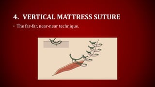 Suturing and its technique | PPTX
