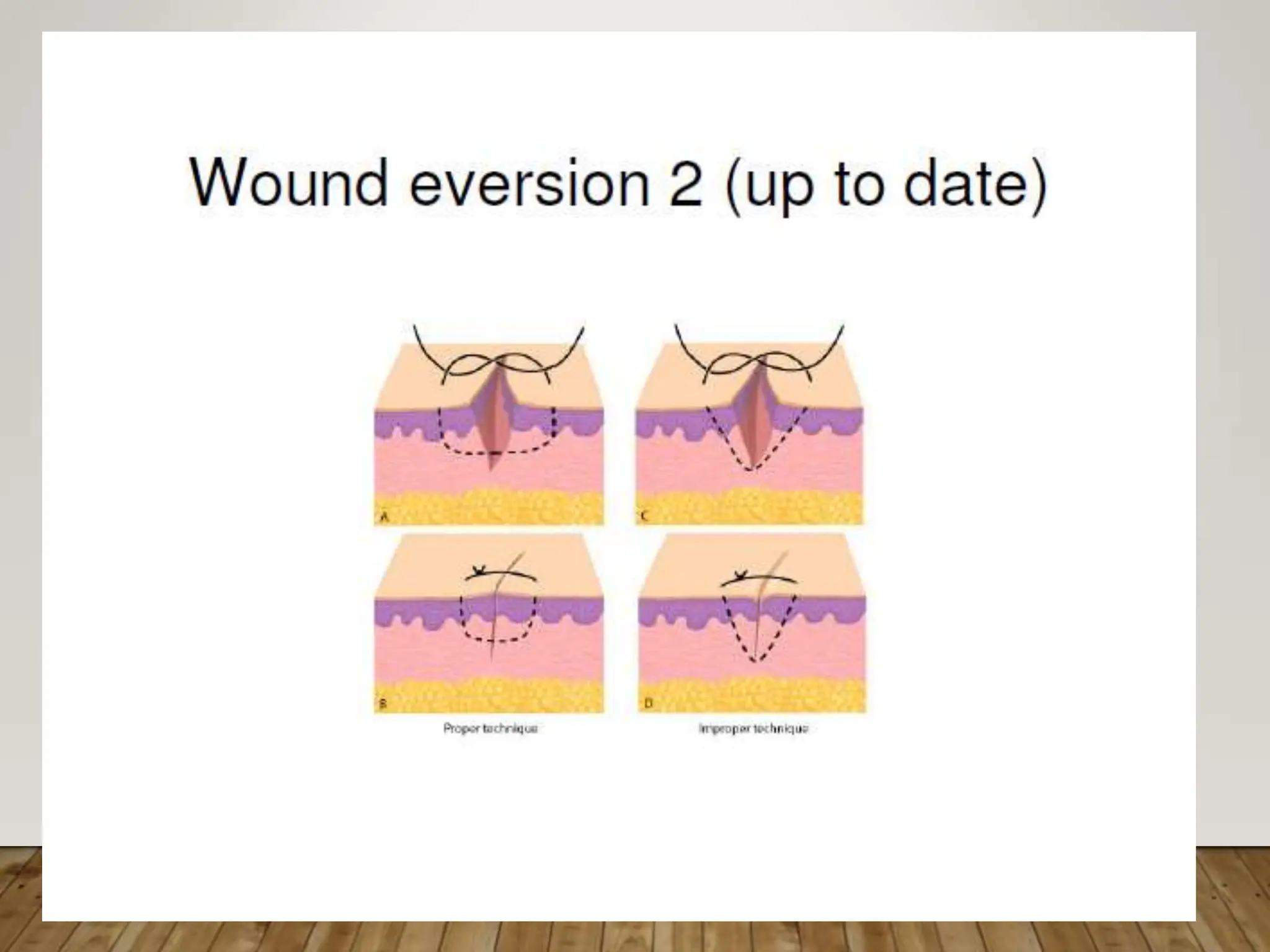 SUTURING AND SUTURE MATERIALS.lecture.pptx