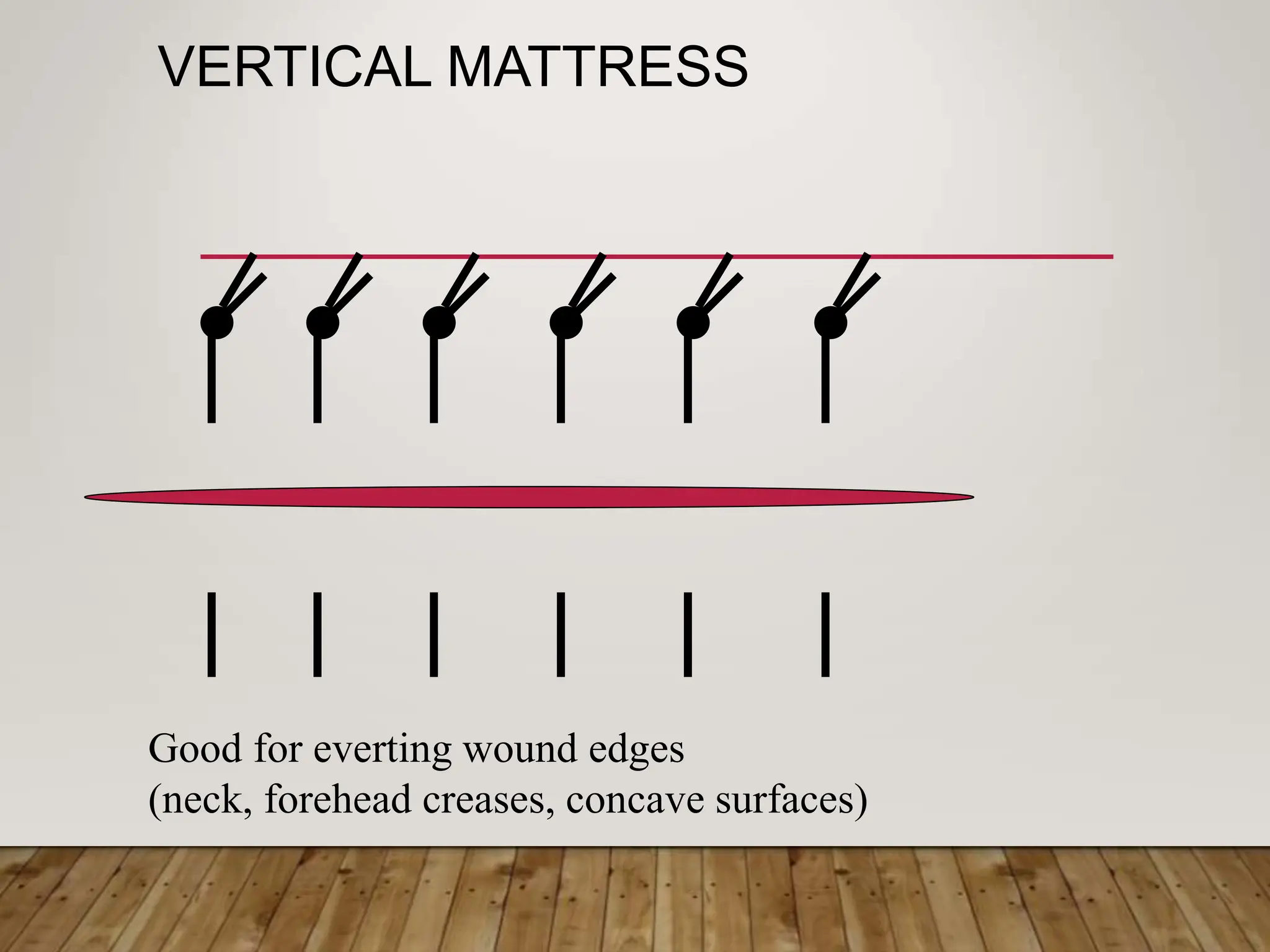 SUTURING AND SUTURE MATERIALS.lecture.pptx