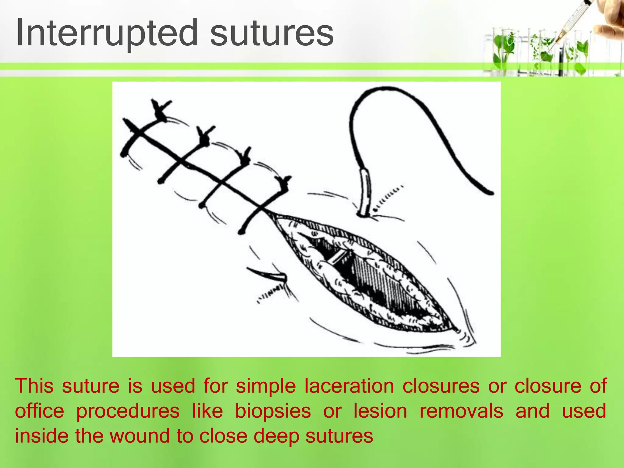 Suturing Dr Bijendra Shah ppt | PPT