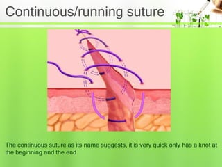 Suturing Dr Bijendra Shah ppt | PPT