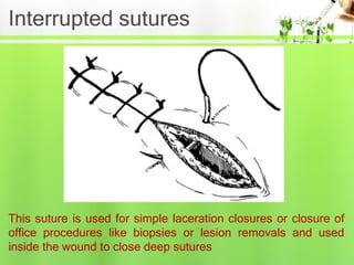 Suturing Dr Bijendra Shah ppt | PPT