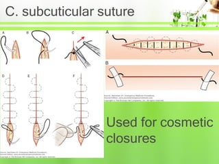 Suturing Dr Bijendra Shah ppt | PPT