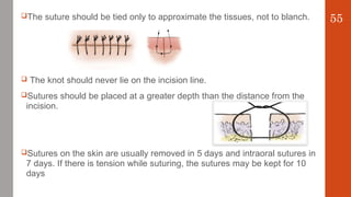 SUTURING MATERIAL used in oral and maxillofacial surgery | PPTX