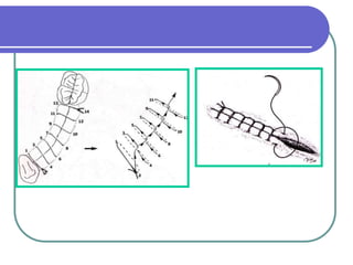 Continuous Locking Stitch