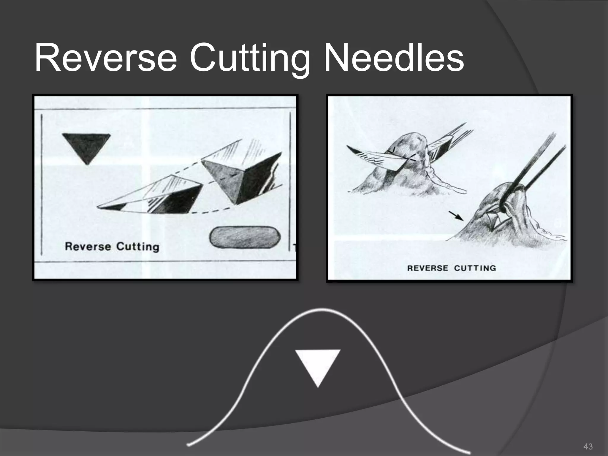 Suturing materials,techniques and principles | PPTX