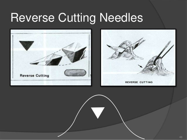 Suturing materials,techniques and principles