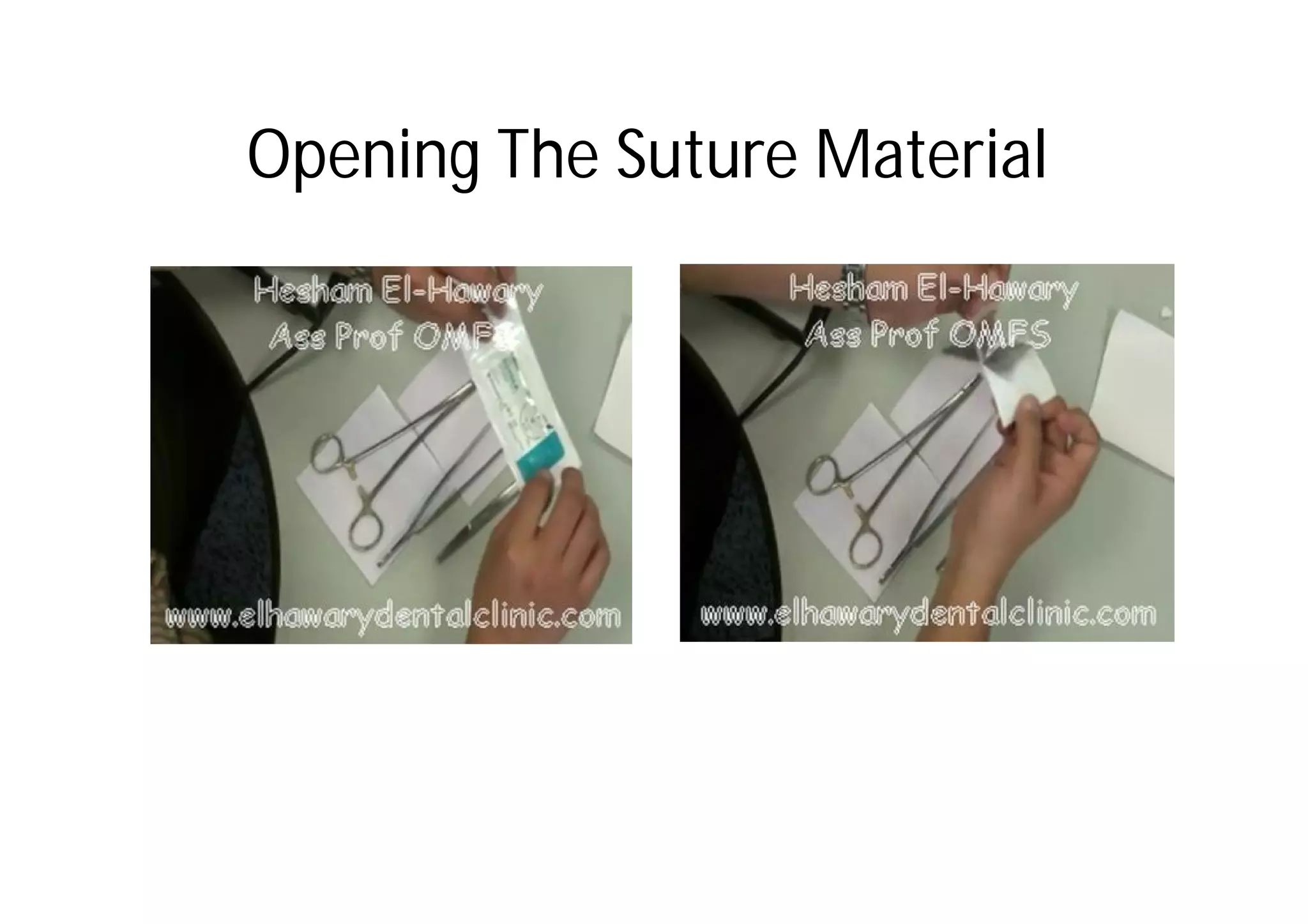 Suturing; principles, armamentarium and techniques | PDF