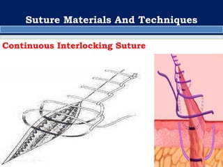 Suturing technique | PDF | Surgery | Medical Health