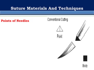 Suturing technique | PPT