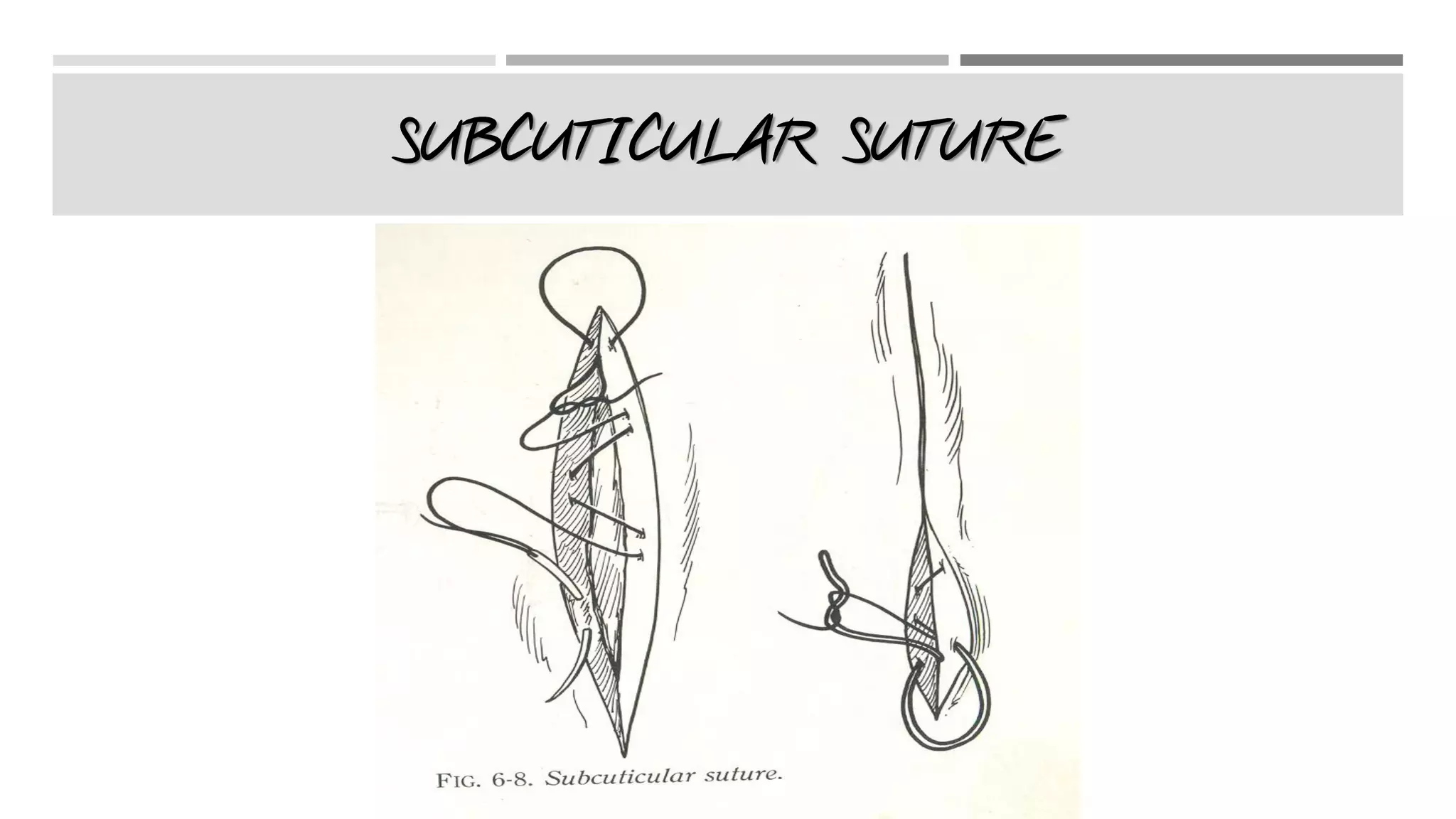 Suturing Techniques | PDF