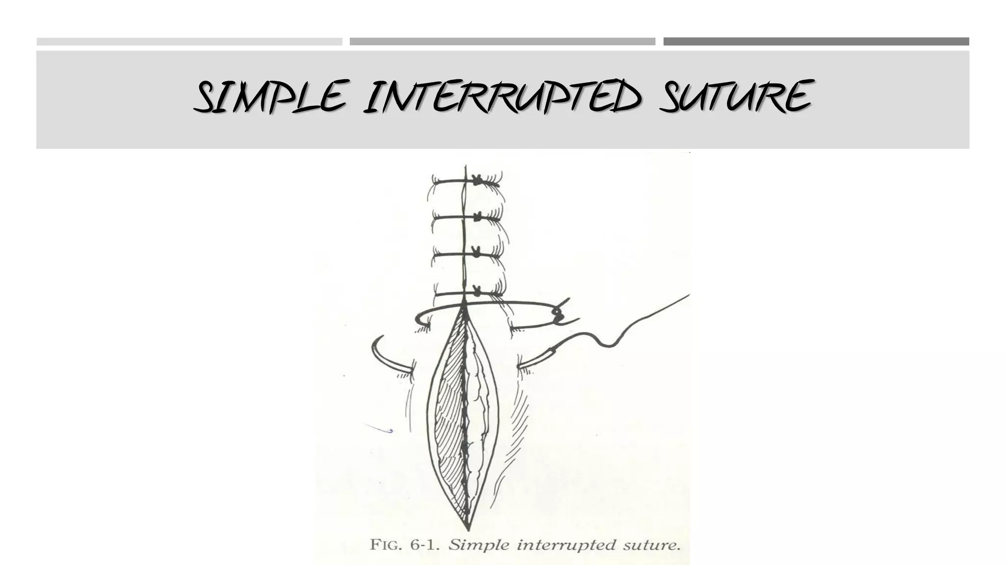 Suturing Techniques | PDF