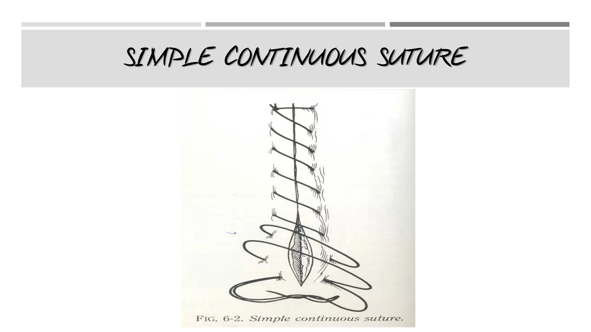 Suturing Techniques | PDF