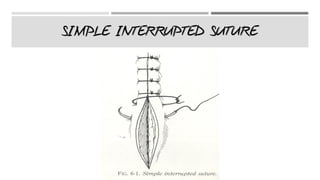 Suturing Techniques | PDF