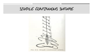 Suturing Techniques | PDF
