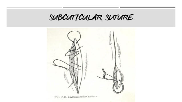 Suturing Techniques
