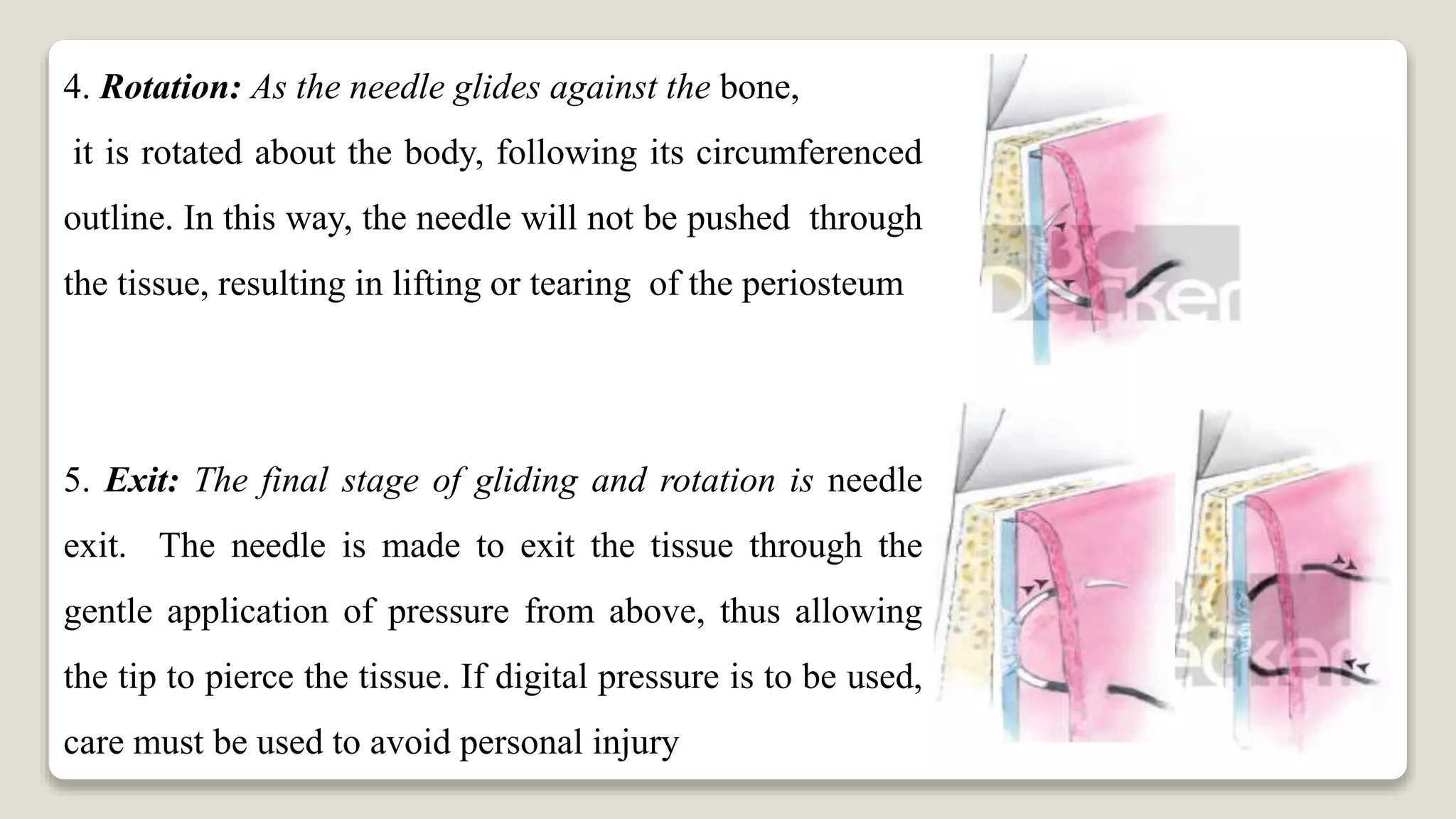 Suturing techniques | PPTX