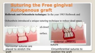Suturing techniques | PPT