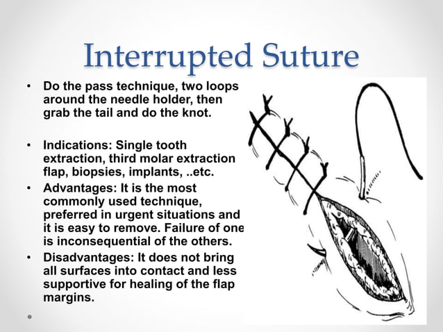 Suturing techniques involved in dental surgery | PPTX