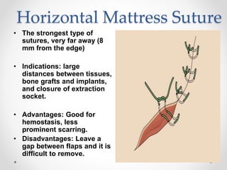 Suturing techniques involved in dental surgery | PPTX