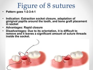 Suturing techniques involved in dental surgery | PPTX