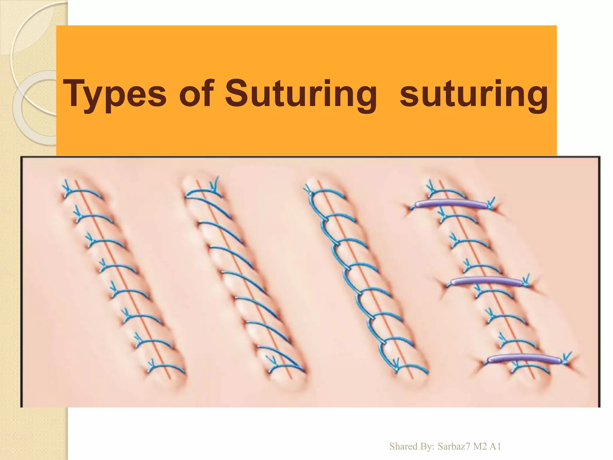 Sutures, Incisions and Mesh.ppt