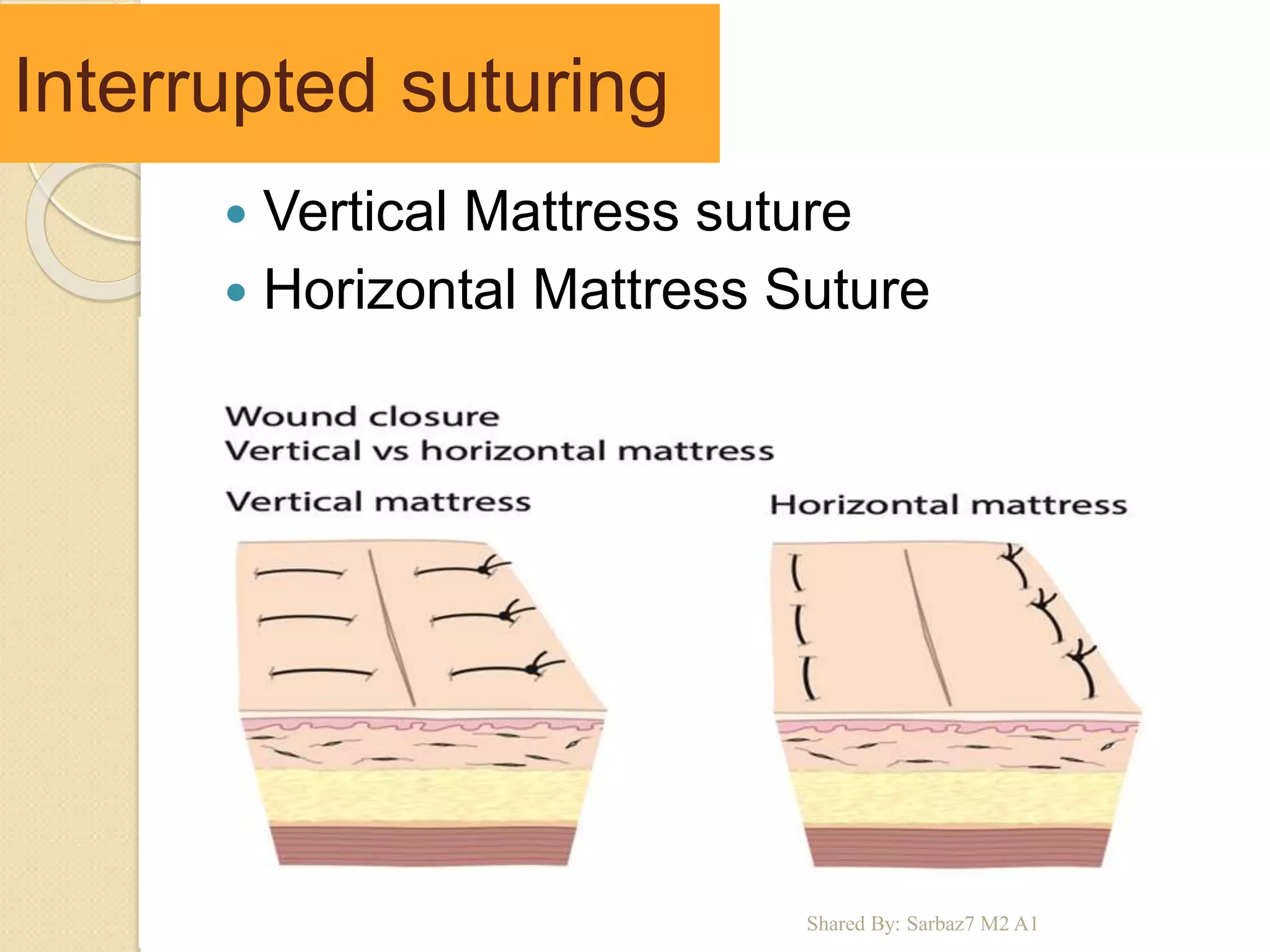 Sutures, Incisions and Mesh.ppt