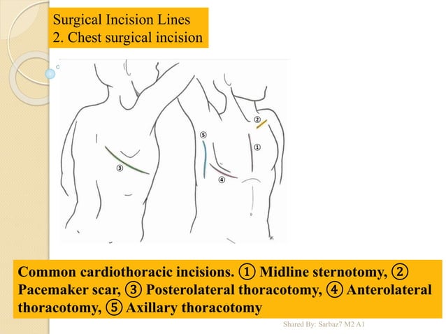 Sutures, Incisions and Mesh.ppt