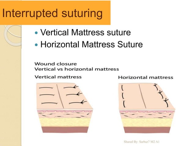 Sutures, Incisions and Mesh.ppt