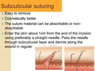 Sutures, Incisions and Mesh.ppt