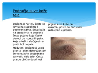 Suva koza skracena prezentacija u plavoj | PPT