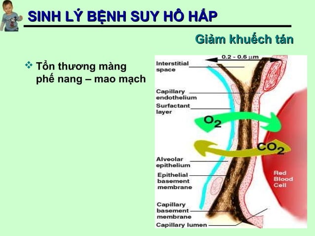Suy hô hấp sơ sinh | PPT