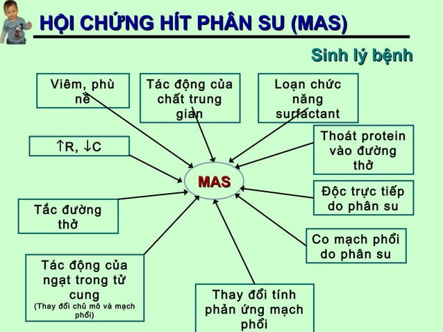 Suy hô hấp sơ sinh | PPT