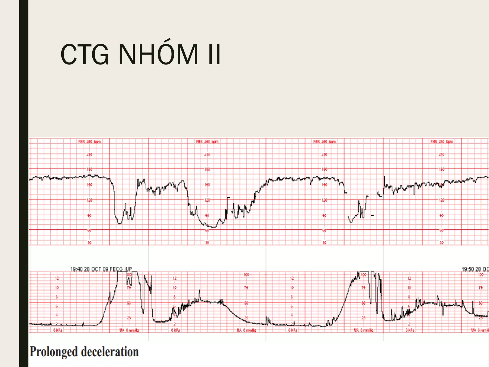SUY THAI CẤP | PDF