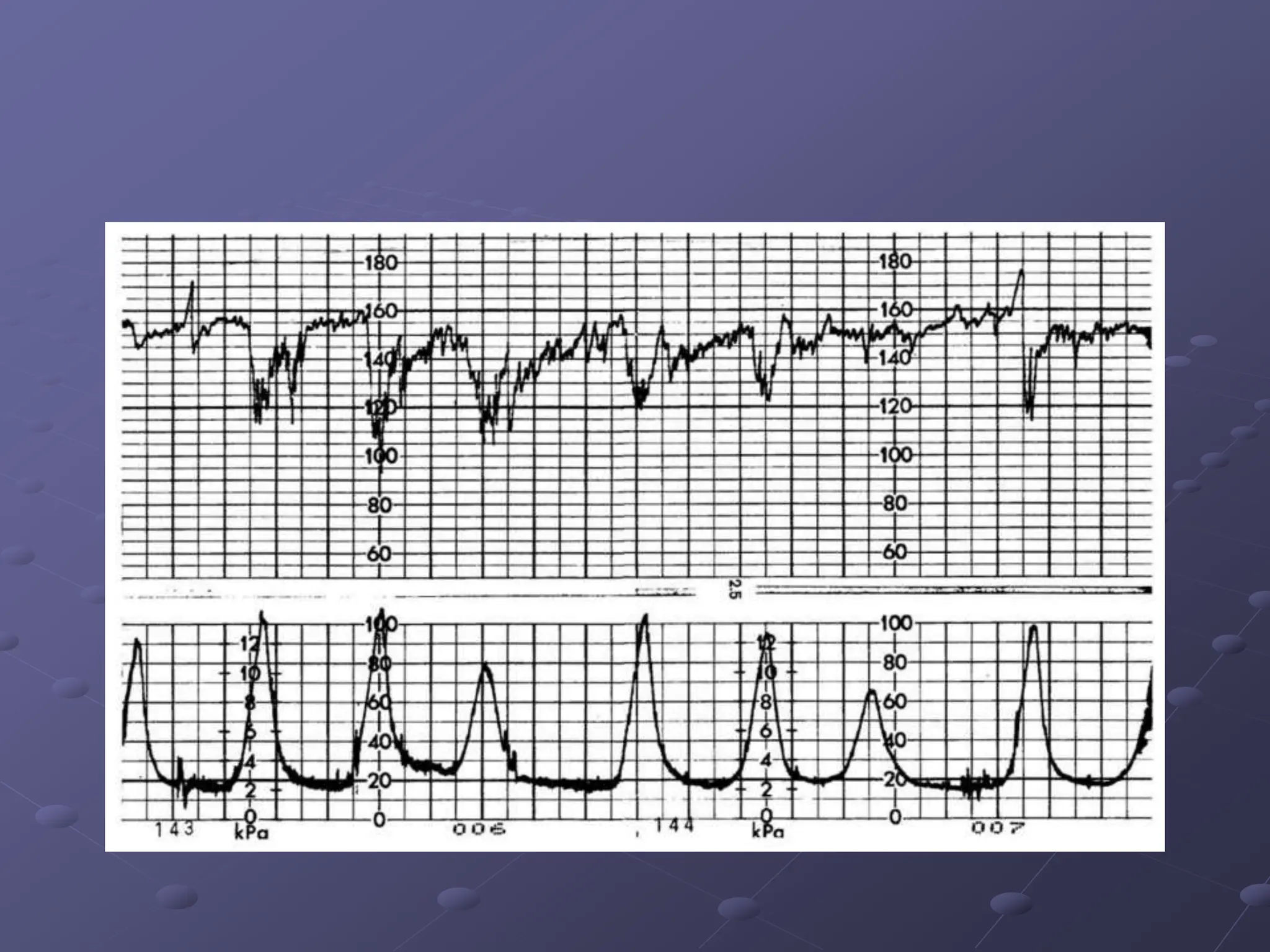 SUY THAI TRONG CHUY_N D_.ppt hay các bạn ạ | PPT